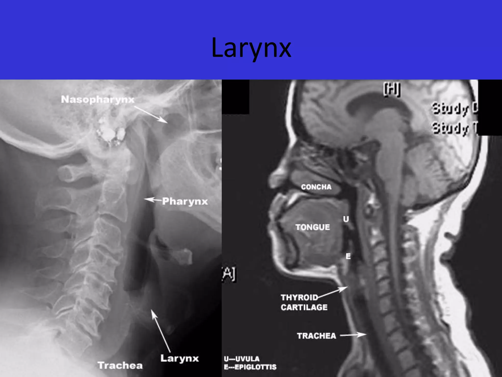 Imaging in ent | PPTX