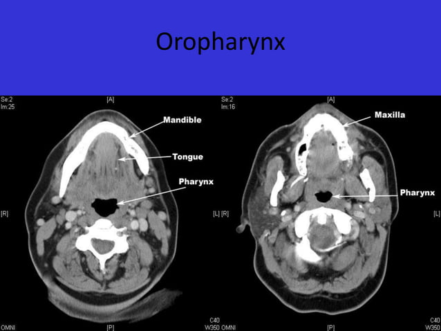 Imaging in ent | PPTX