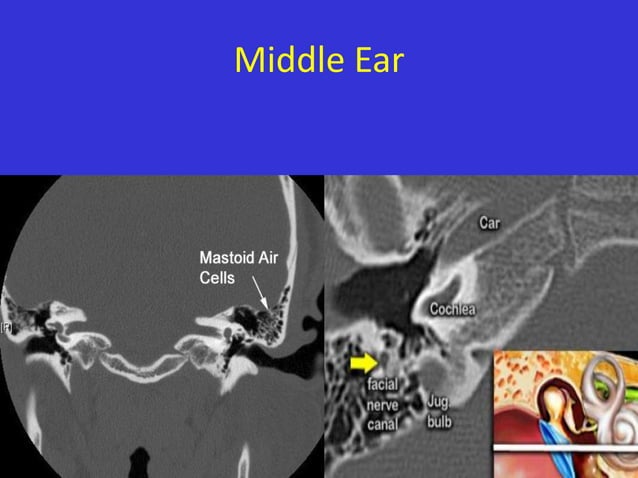 Imaging in ent | PPTX