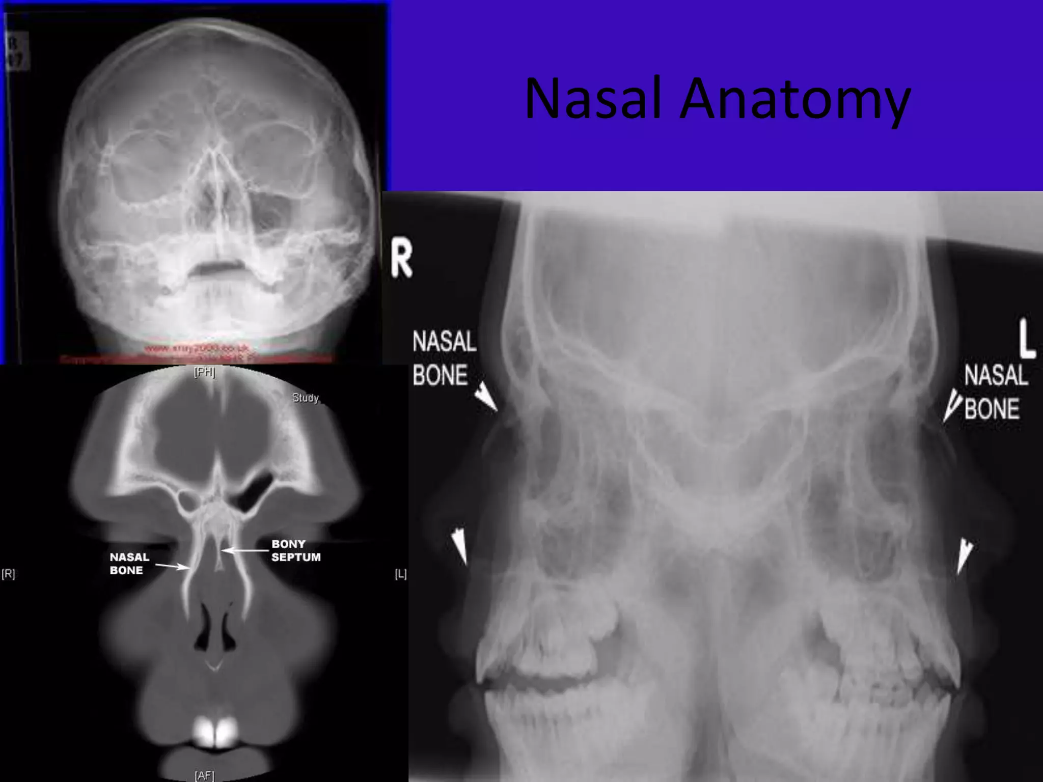 Imaging in ent | PPTX