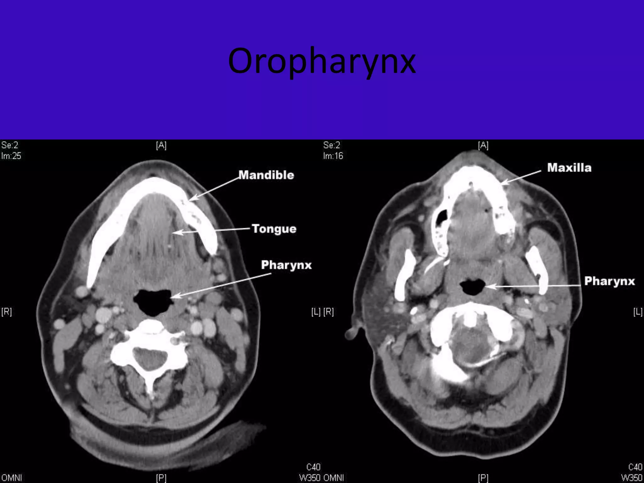 Imaging in ent | PPTX | Ear, Nose and Throat Conditions | Diseases and ...