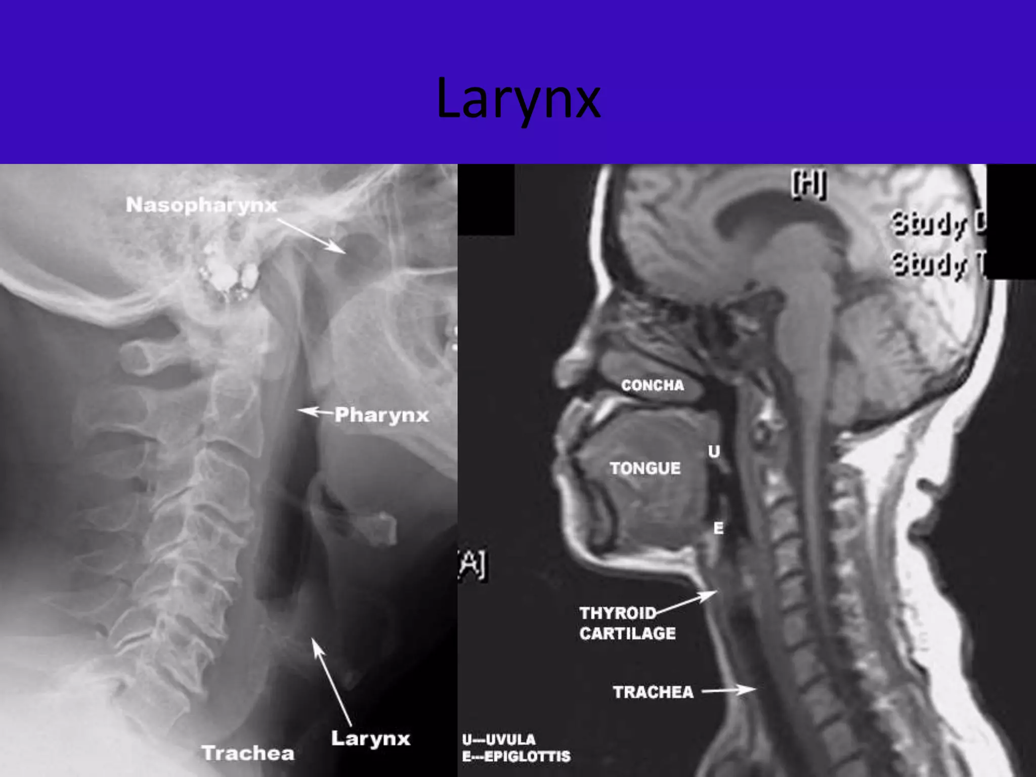 Imaging in ent | PPTX