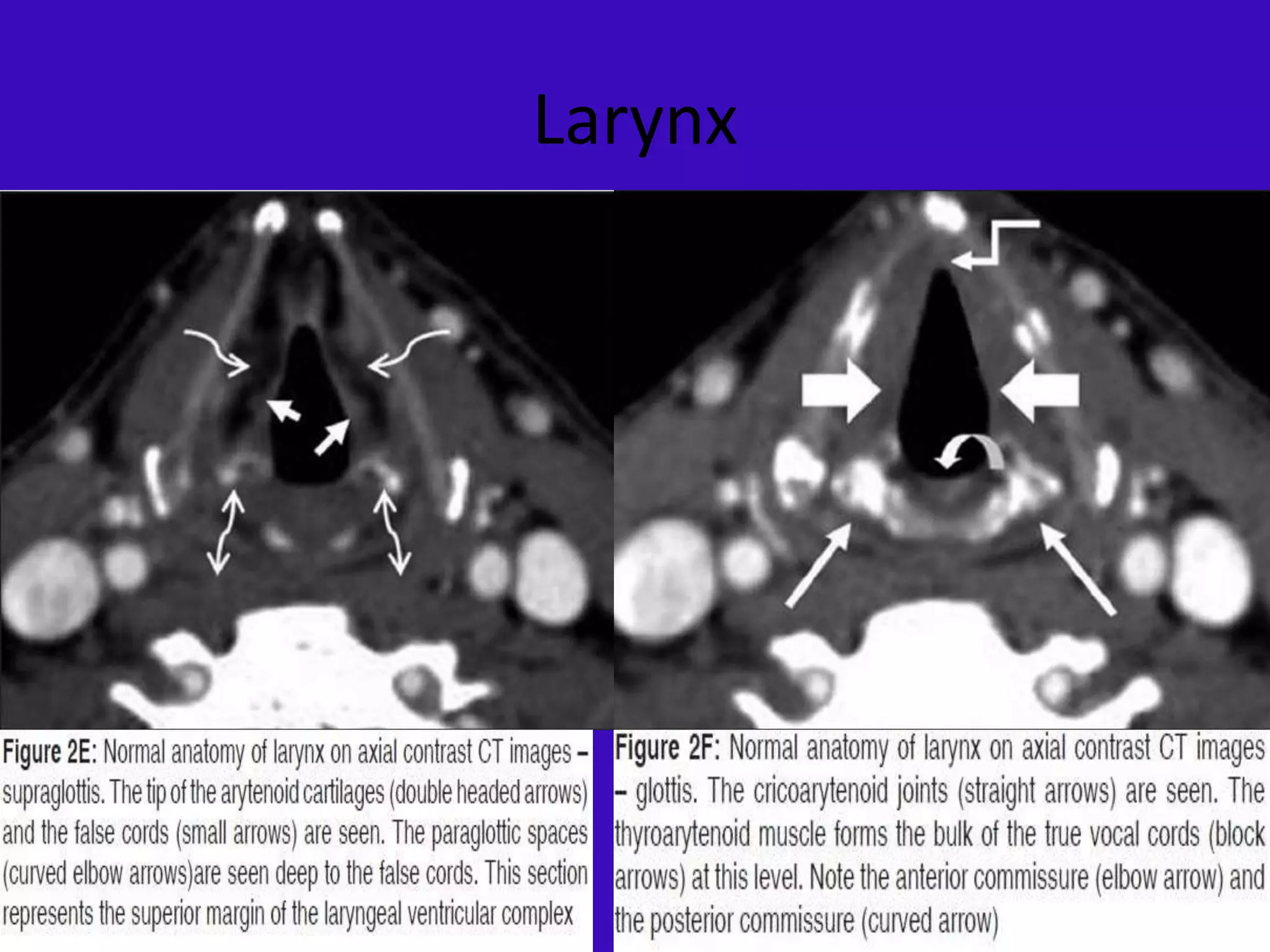 Imaging in ent | PPTX | Ear, Nose and Throat Conditions | Diseases and ...