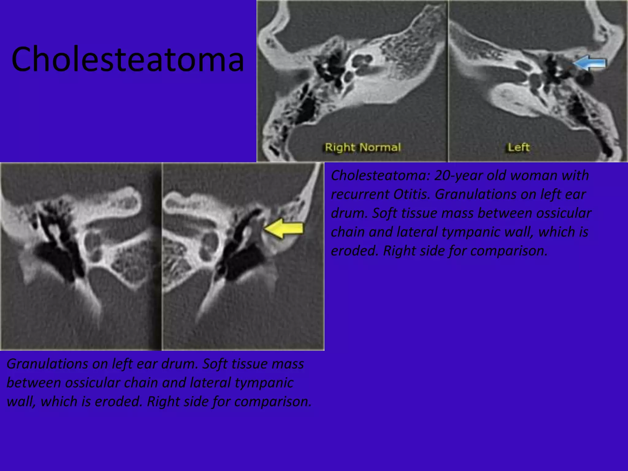 Imaging in ent | PPTX | Ear, Nose and Throat Conditions | Diseases and ...