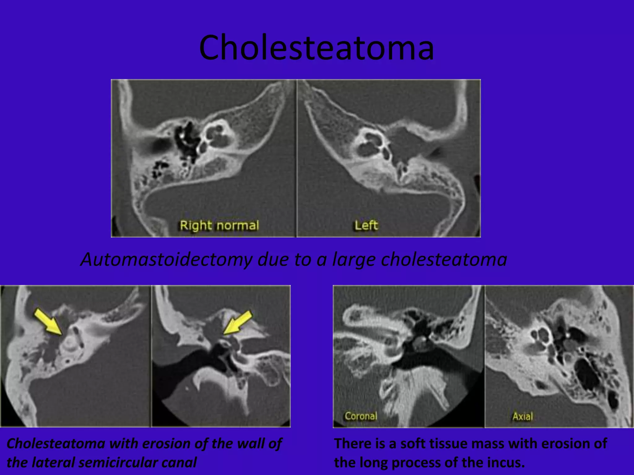 Imaging in ent | PPTX | Ear, Nose and Throat Conditions | Diseases and ...