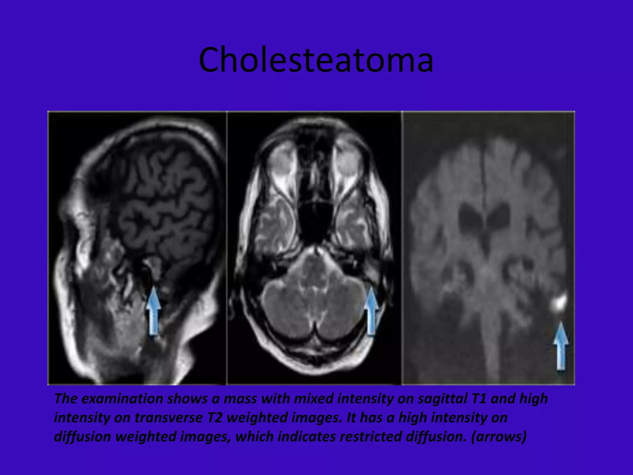 Imaging in ent | PPTX