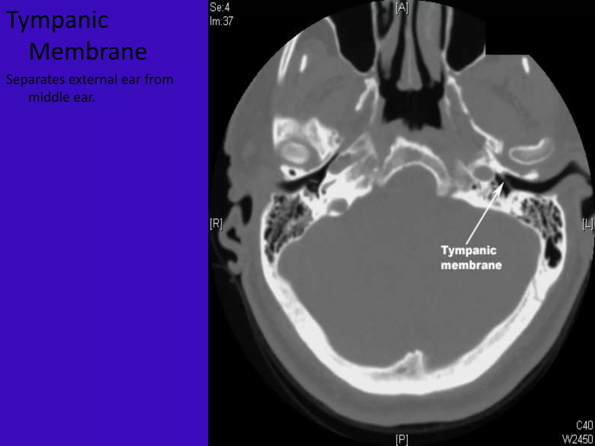 Imaging in ent | PPTX
