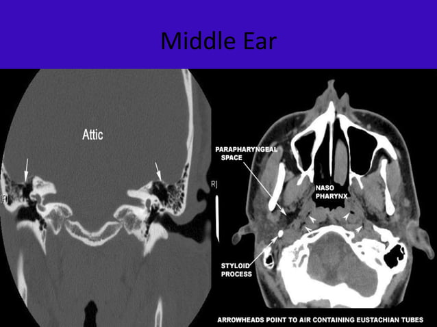 Imaging in ent | PPTX | Ear, Nose and Throat Conditions | Diseases and ...
