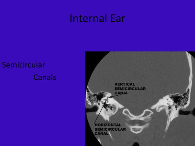 Imaging in ent | PPTX | Ear, Nose and Throat Conditions | Diseases and ...