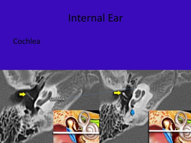Imaging in ent | PPTX | Ear, Nose and Throat Conditions | Diseases and ...