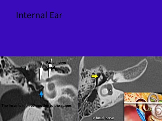 Imaging in ent | PPTX | Ear, Nose and Throat Conditions | Diseases and ...