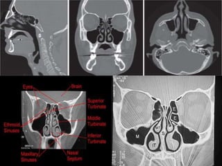 Imaging in ent | PPTX