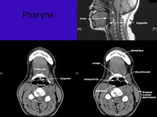 Imaging in ent | PPTX