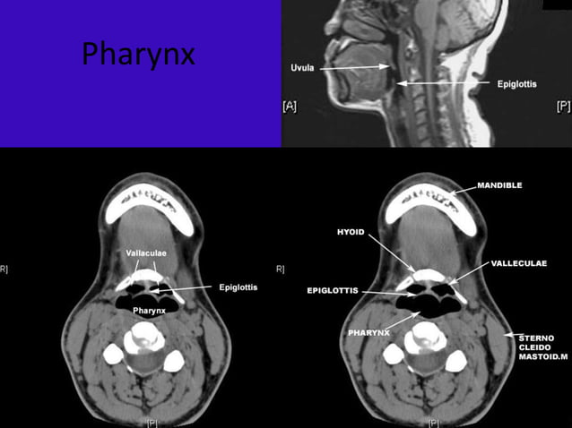 Imaging in ent | PPTX | Ear, Nose and Throat Conditions | Diseases and ...