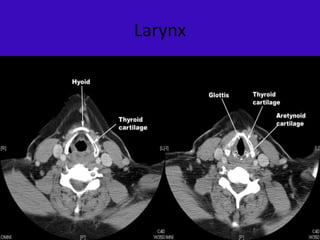 Imaging in ent | PPTX