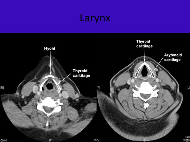 Imaging in ent | PPTX | Ear, Nose and Throat Conditions | Diseases and ...