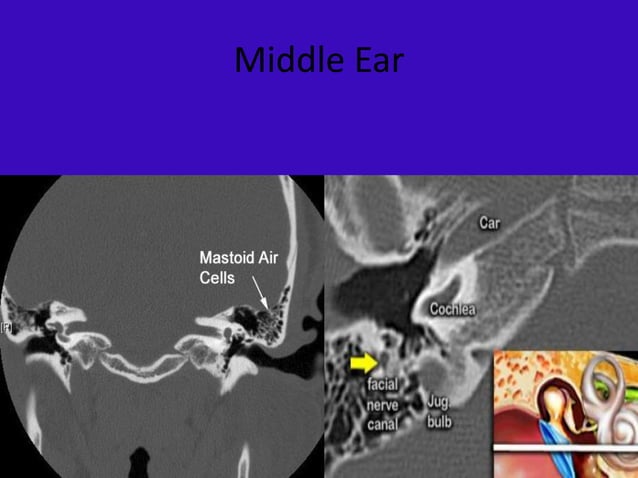 Imaging in ent | PPTX | Ear, Nose and Throat Conditions | Diseases and ...