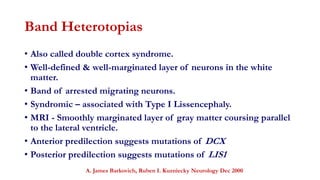 Imaging in epilepsy1 | PPTX