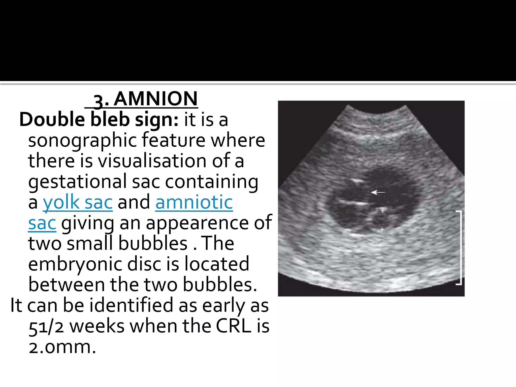 Imaging in first trimester | PPTX