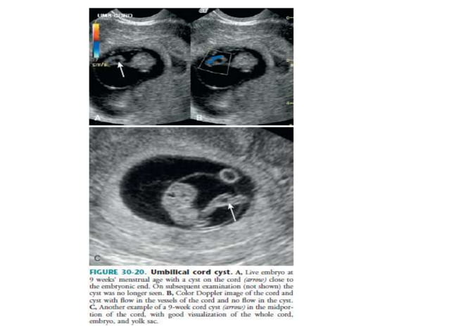 Imaging in first trimester | PPTX | Pregnancy | Reproductive Health