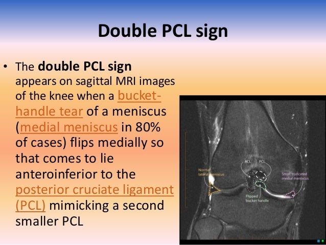 Imaging in fractures