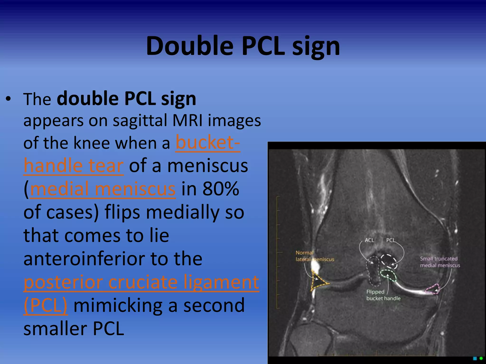 Imaging in Fractures and Dislocations-- An Introduction Dr. Muhammad ...