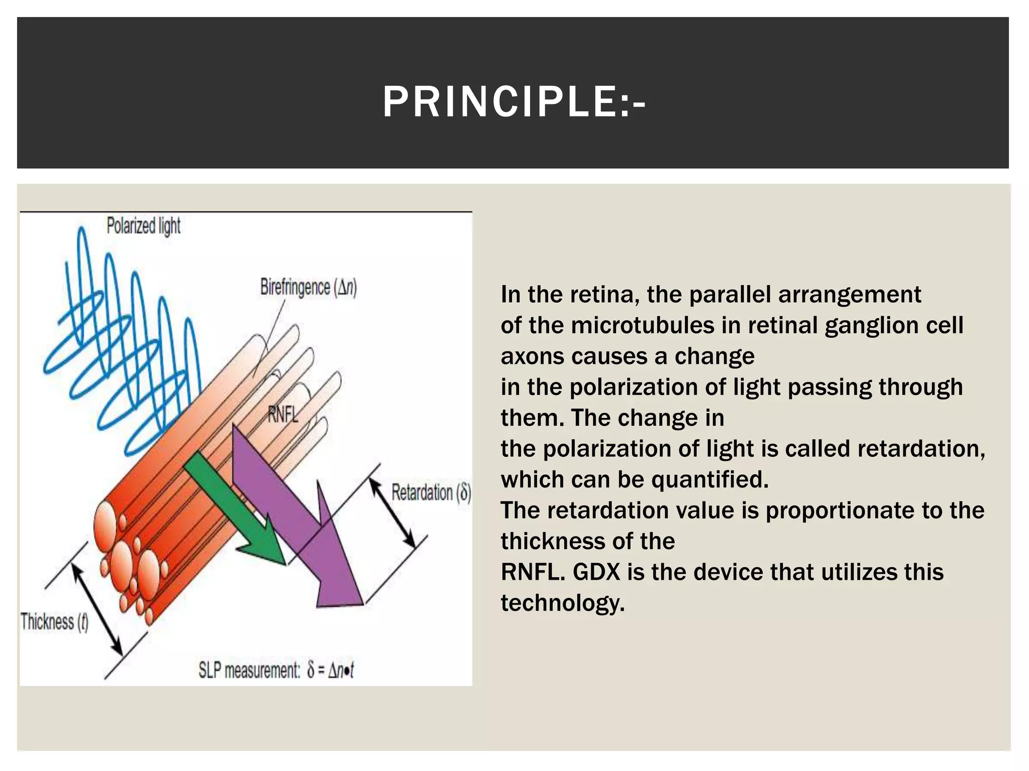 Imaging in glaucoma | PPTX