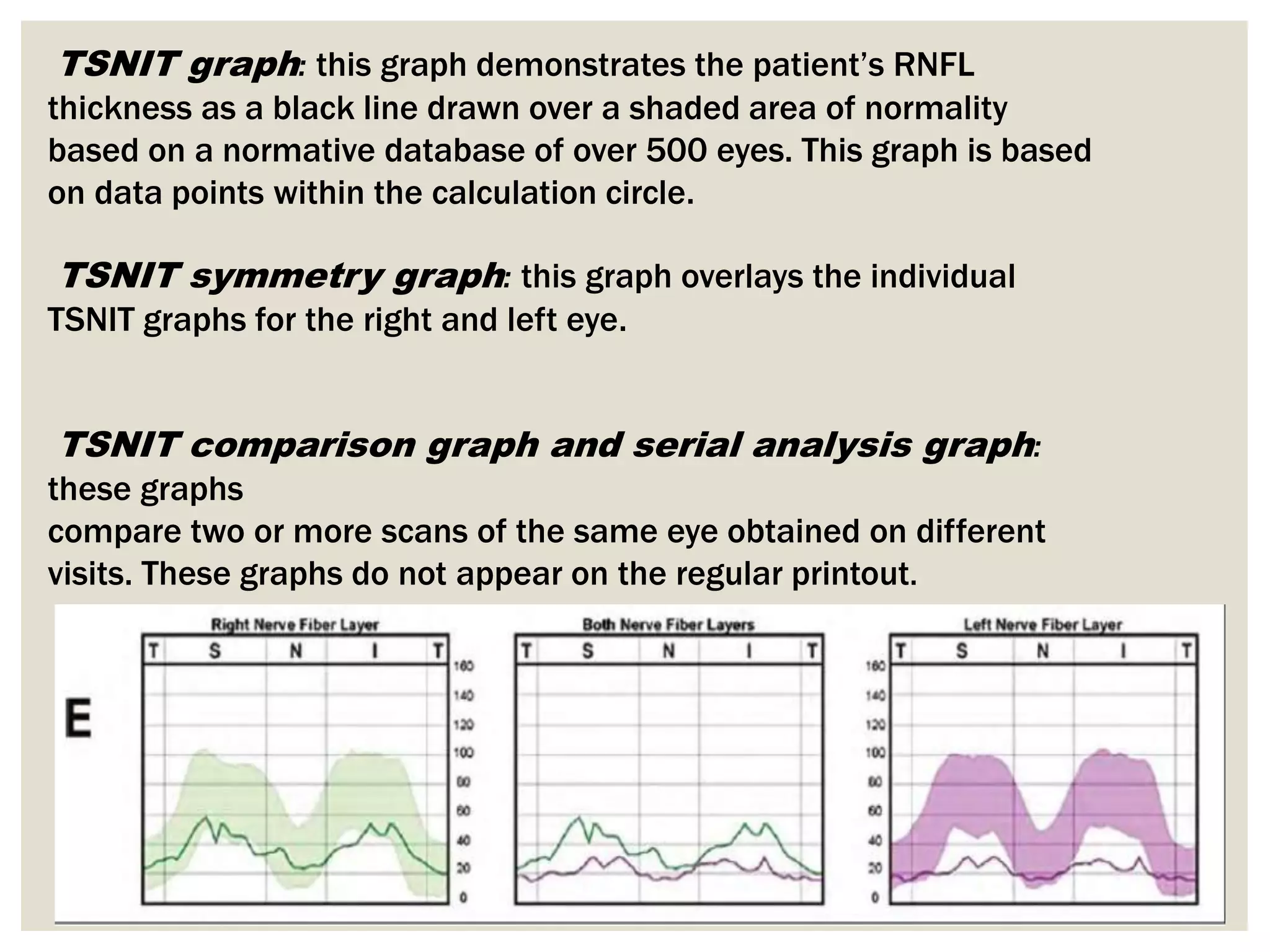 Imaging in glaucoma | PPTX