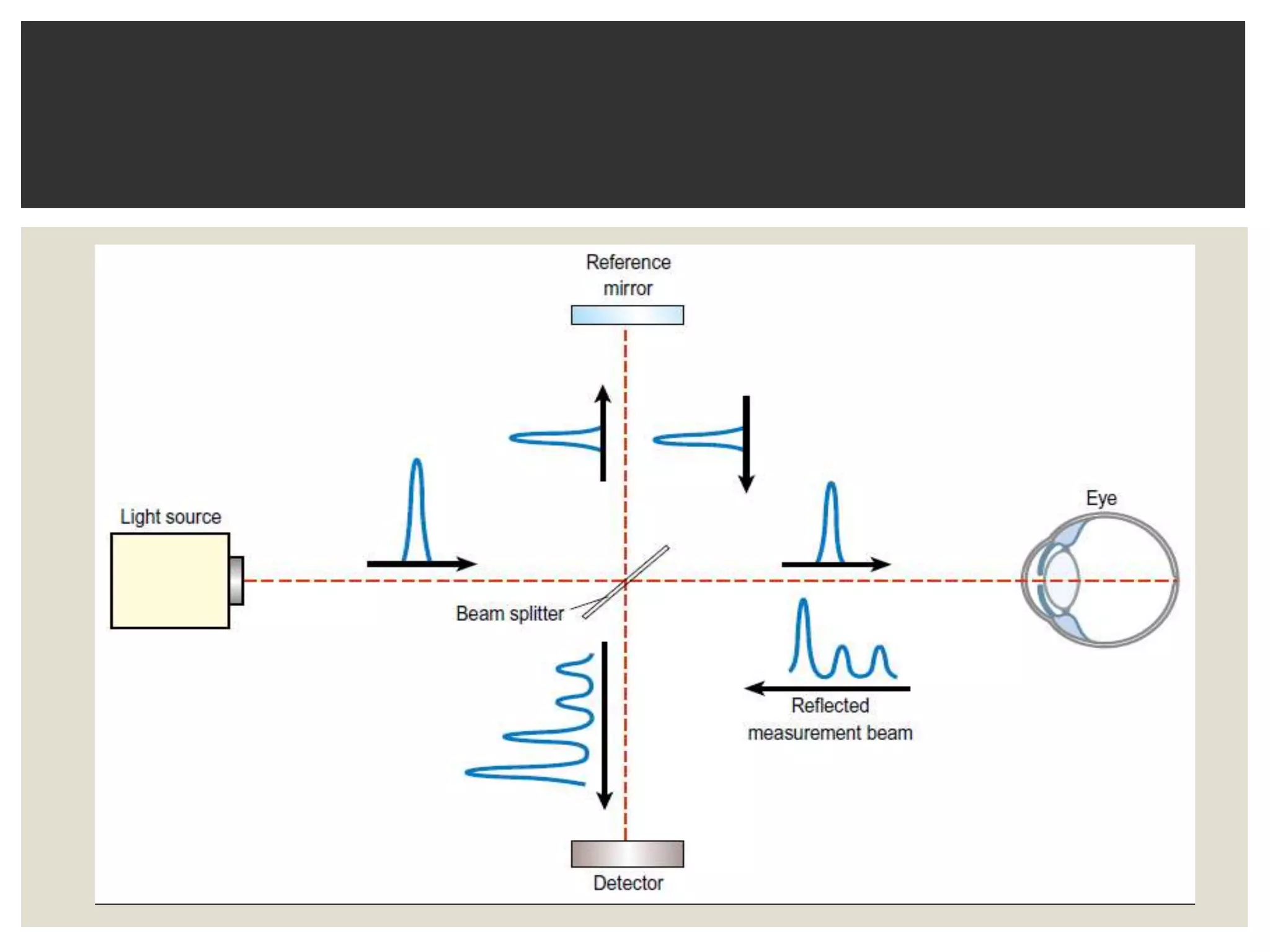 Imaging in glaucoma | PPTX