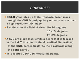 Imaging in glaucoma | PPTX