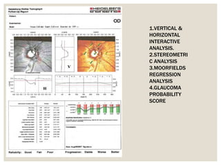 Imaging in glaucoma | PPTX