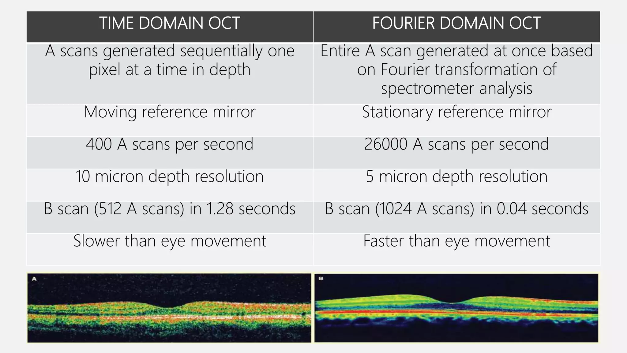 Imaging in Glaucoma | PPTX