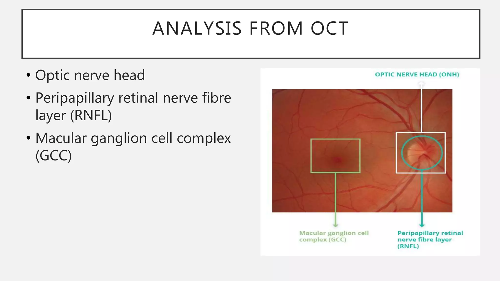 Imaging in Glaucoma | PPTX