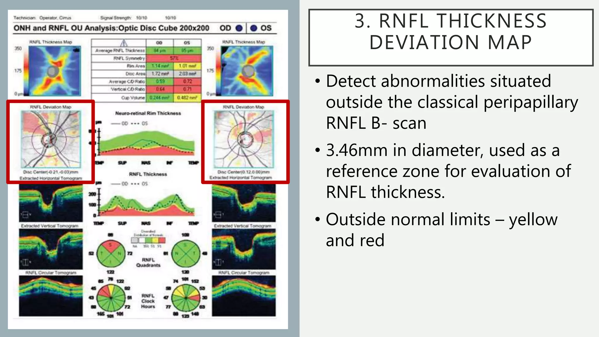 Imaging in Glaucoma | PPTX