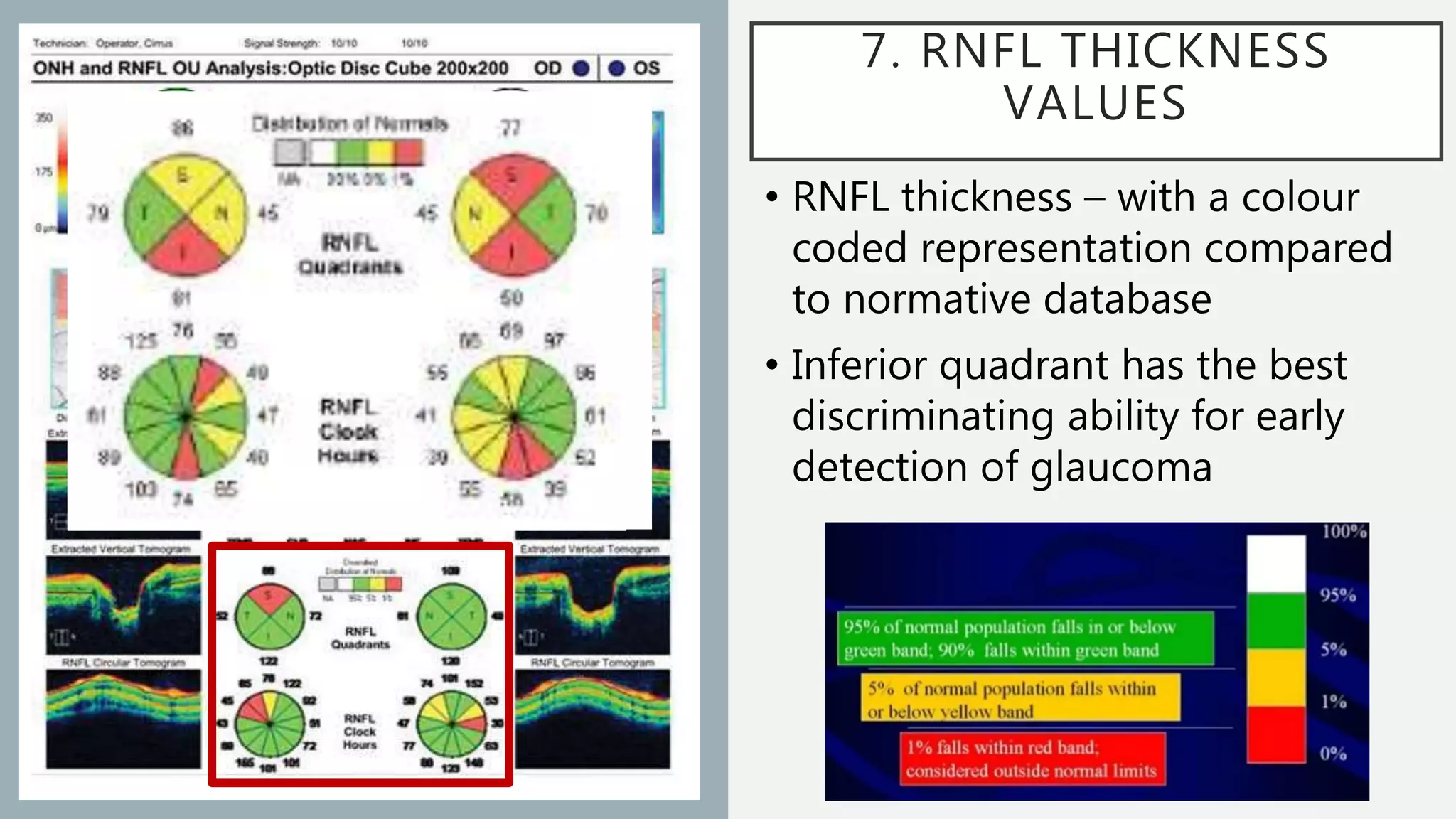 Imaging in Glaucoma | PPTX