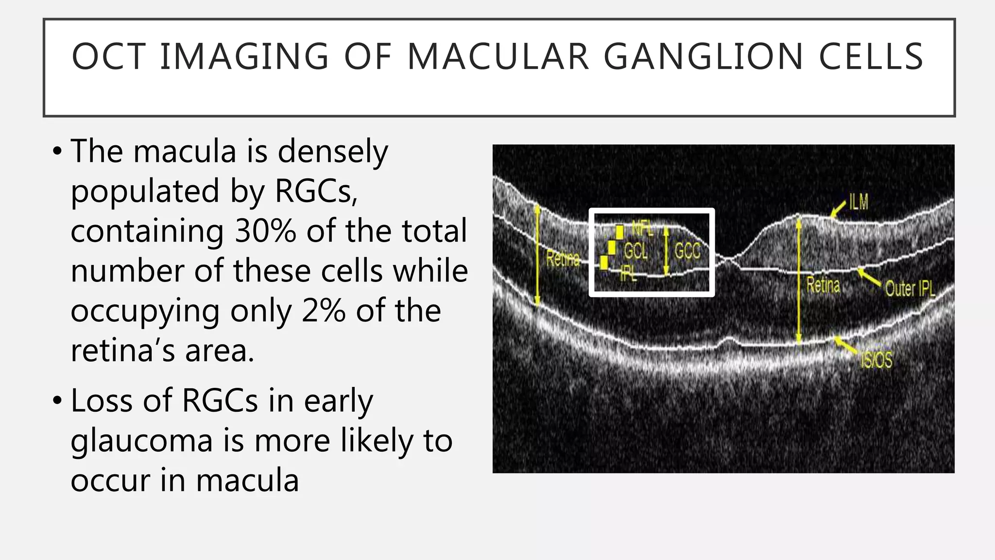 Imaging in Glaucoma | PPTX
