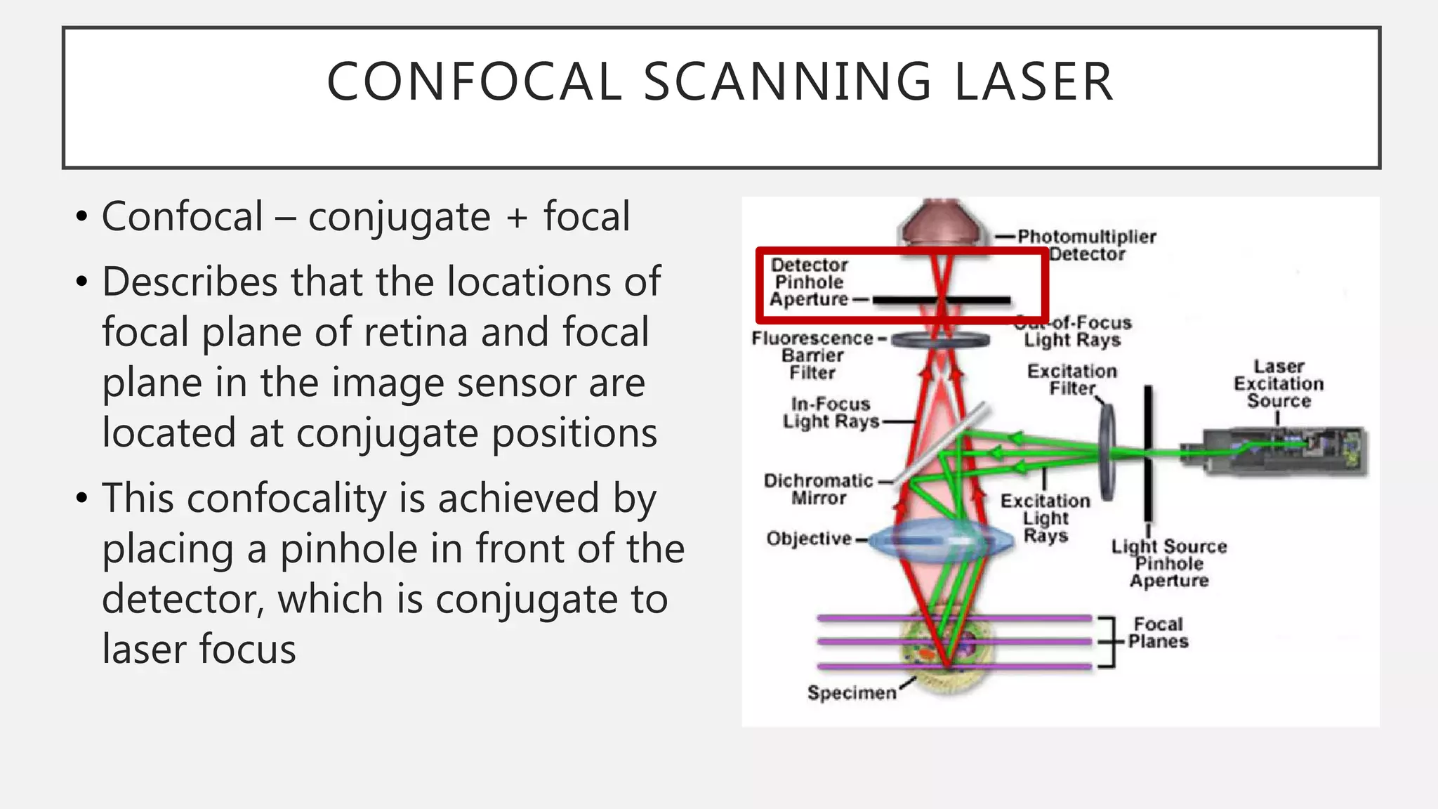 Imaging in Glaucoma | PPTX