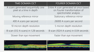 Imaging in Glaucoma | PPTX