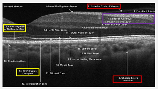 Imaging in Glaucoma | PPTX | Eye and Vision Conditions | Diseases and ...