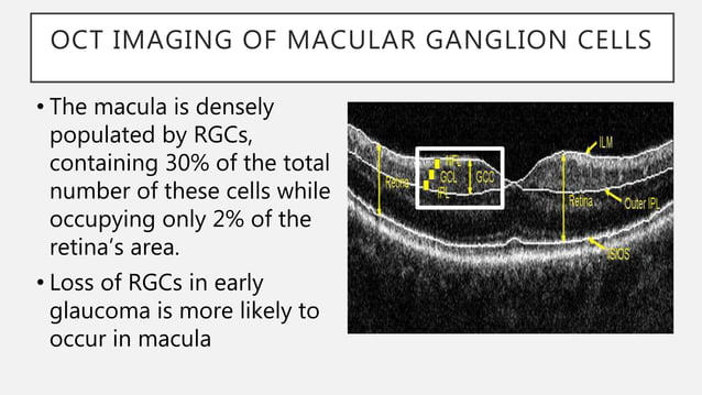 Imaging in Glaucoma | PPTX | Eye and Vision Conditions | Diseases and ...