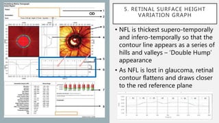 Imaging in Glaucoma | PPTX