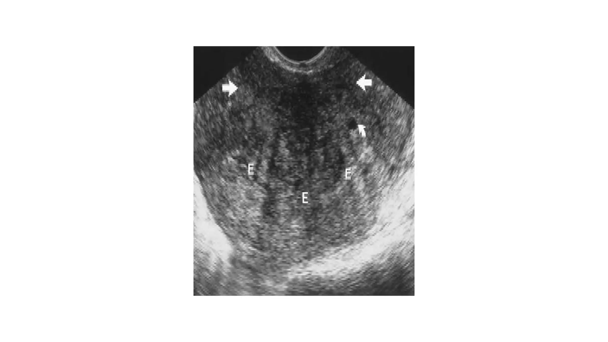 Imaging in gynaecology | PPTX