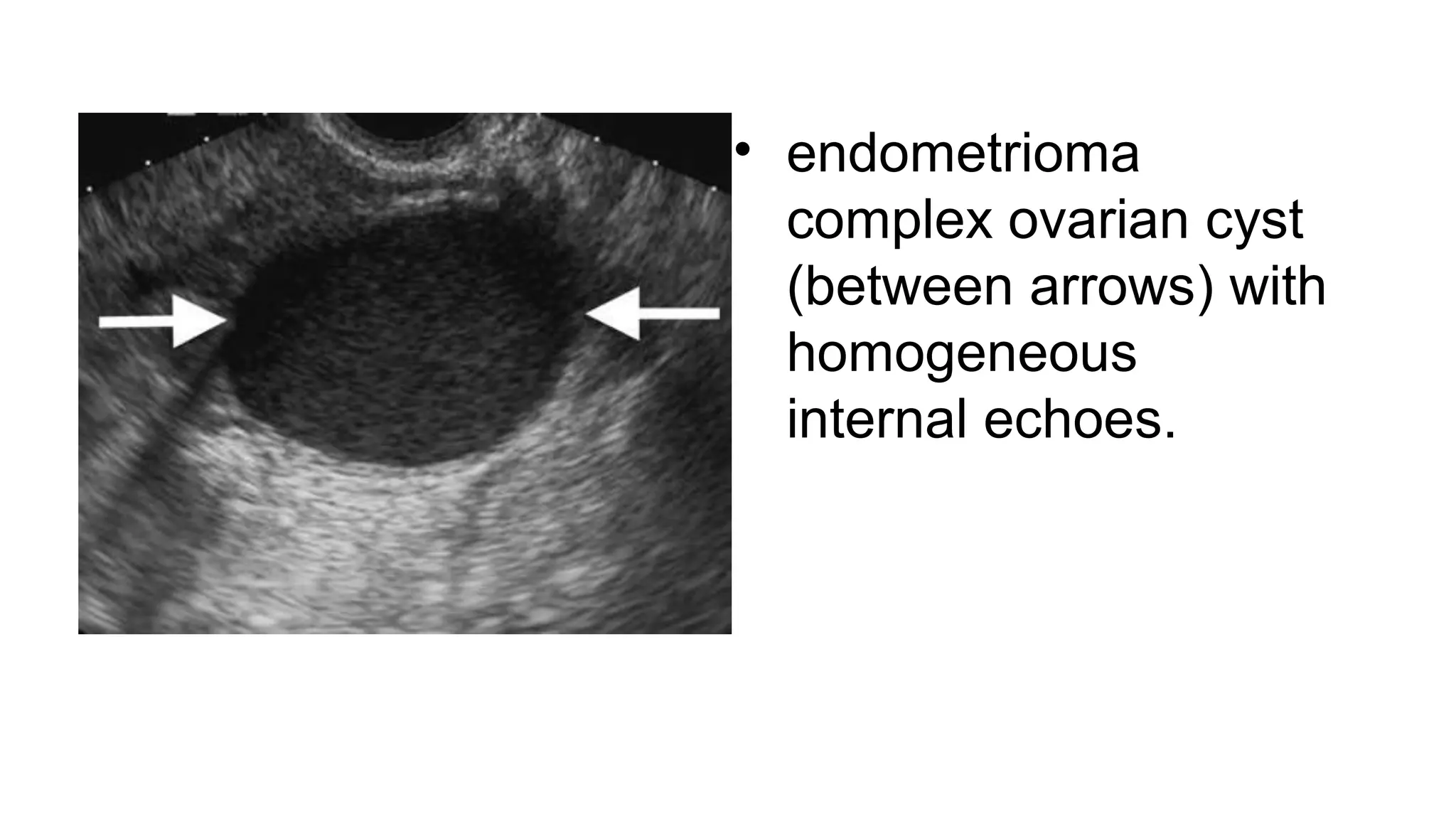 Imaging in gynaecology | PPTX