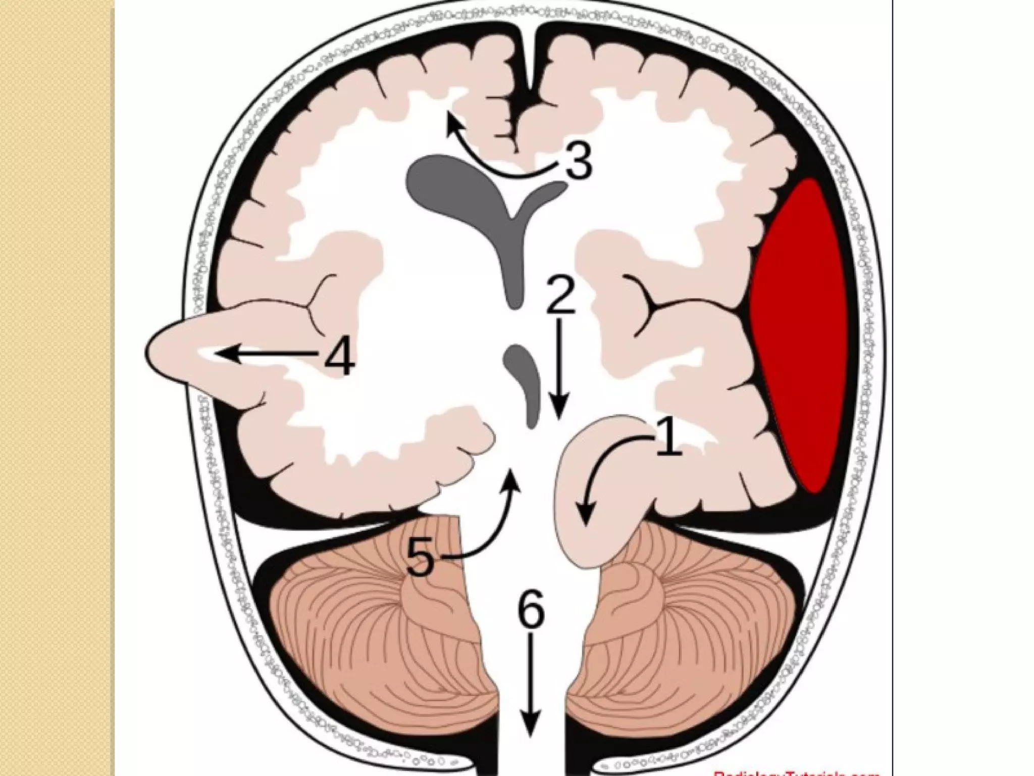 Imaging in head trauma | PPT