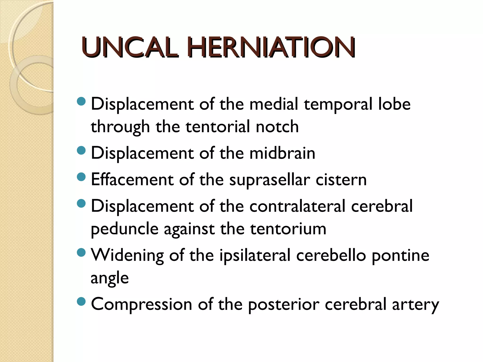 Imaging in head trauma | PPT