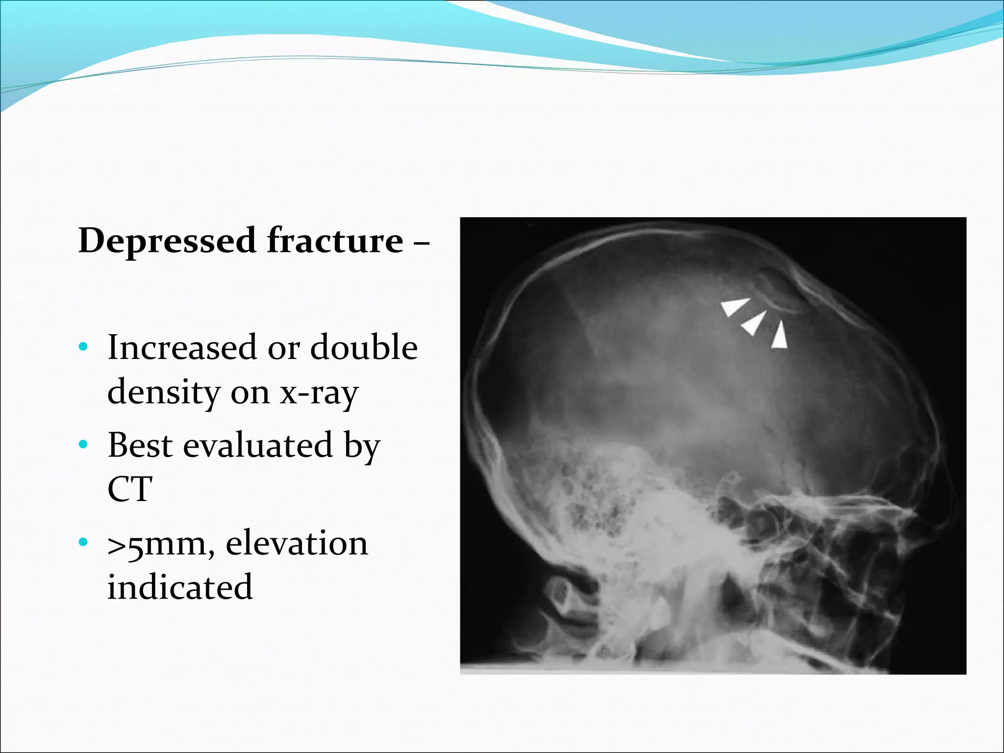 Imaging in head trauma | PPT