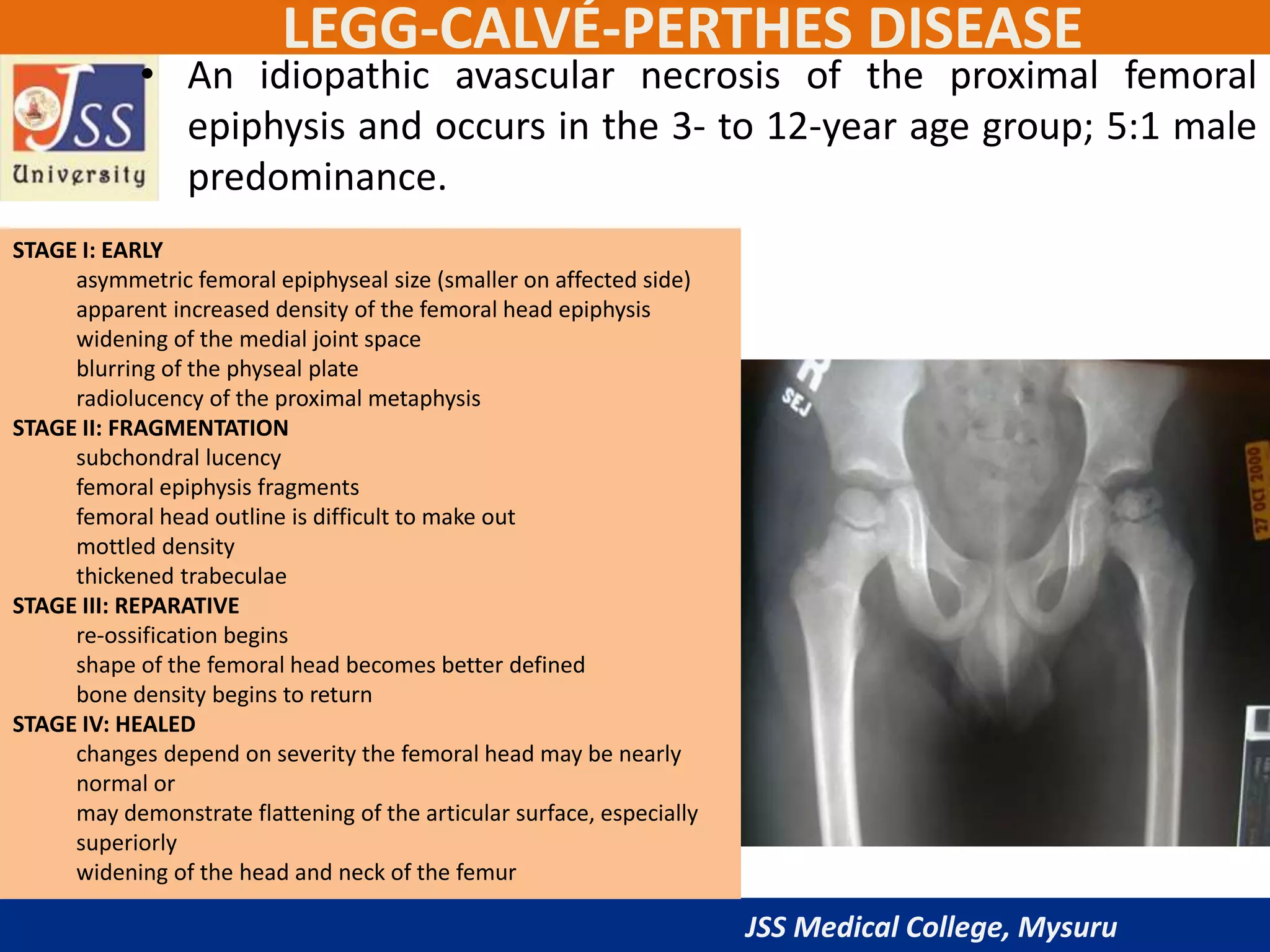 Imaging in hip disorders | PPTX