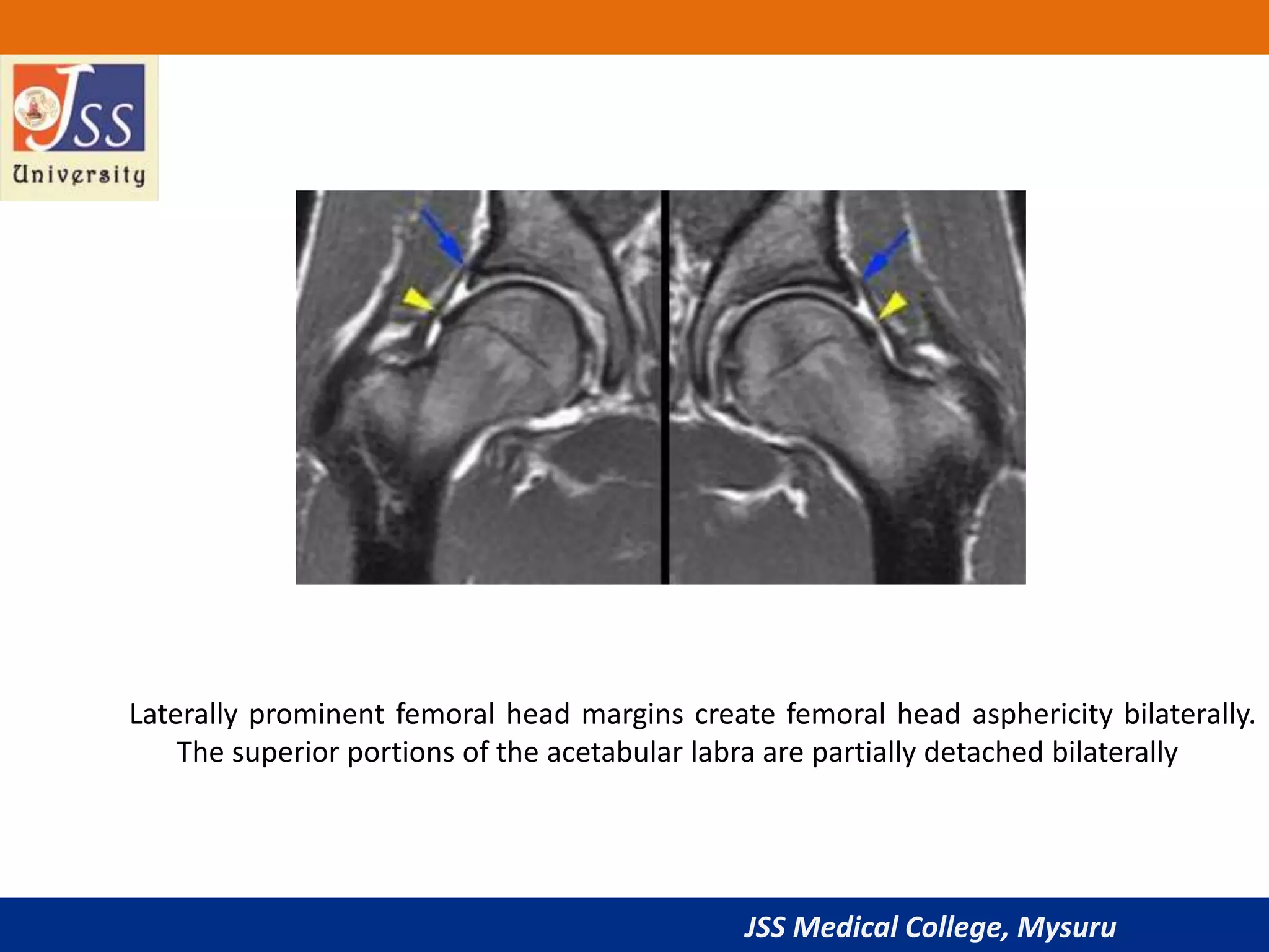 Imaging in hip disorders | PPTX