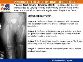 Imaging in hip disorders | PPTX