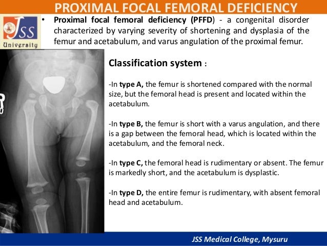 Imaging in hip disorders
